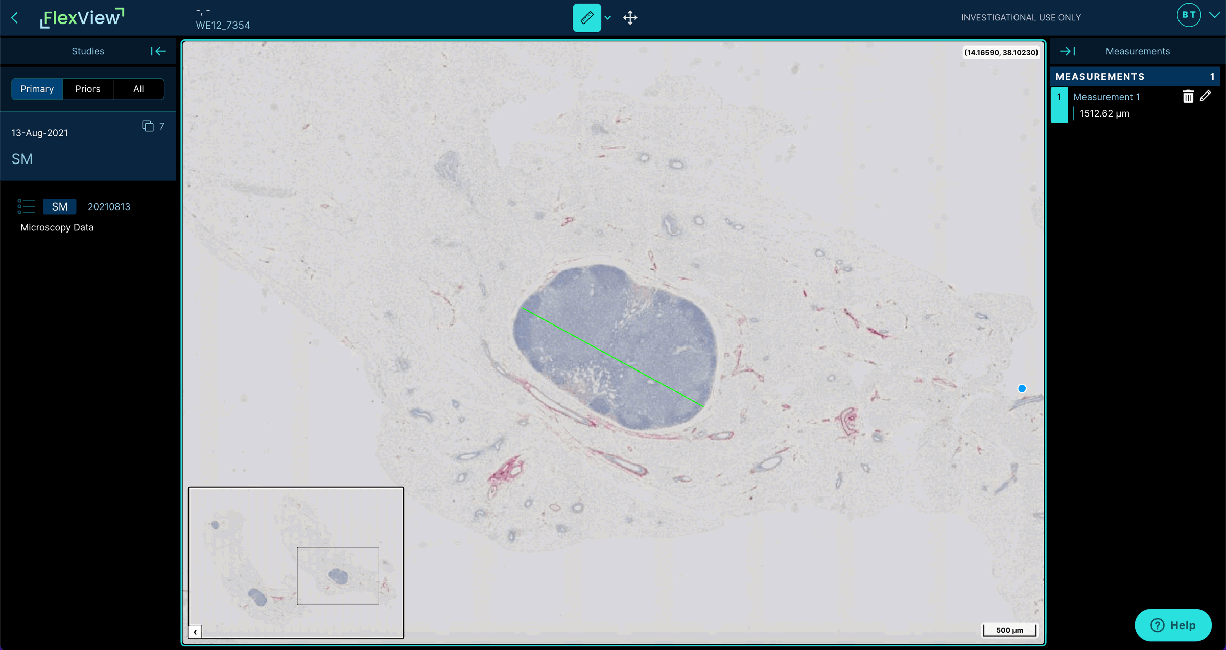 Digital Pathology │ Solutions │ FlexView