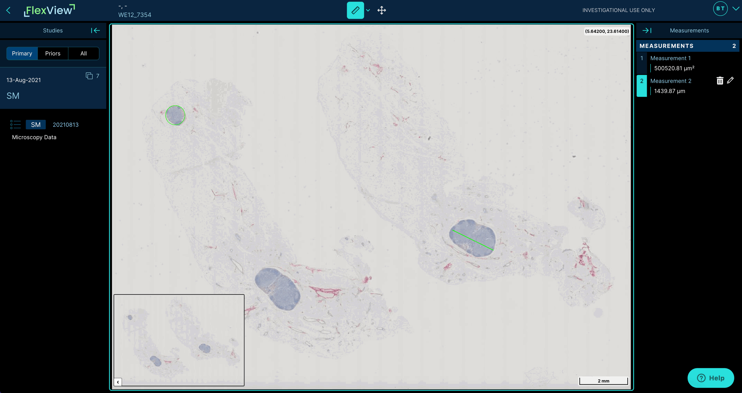Digital Pathology │ Solutions │ FlexView