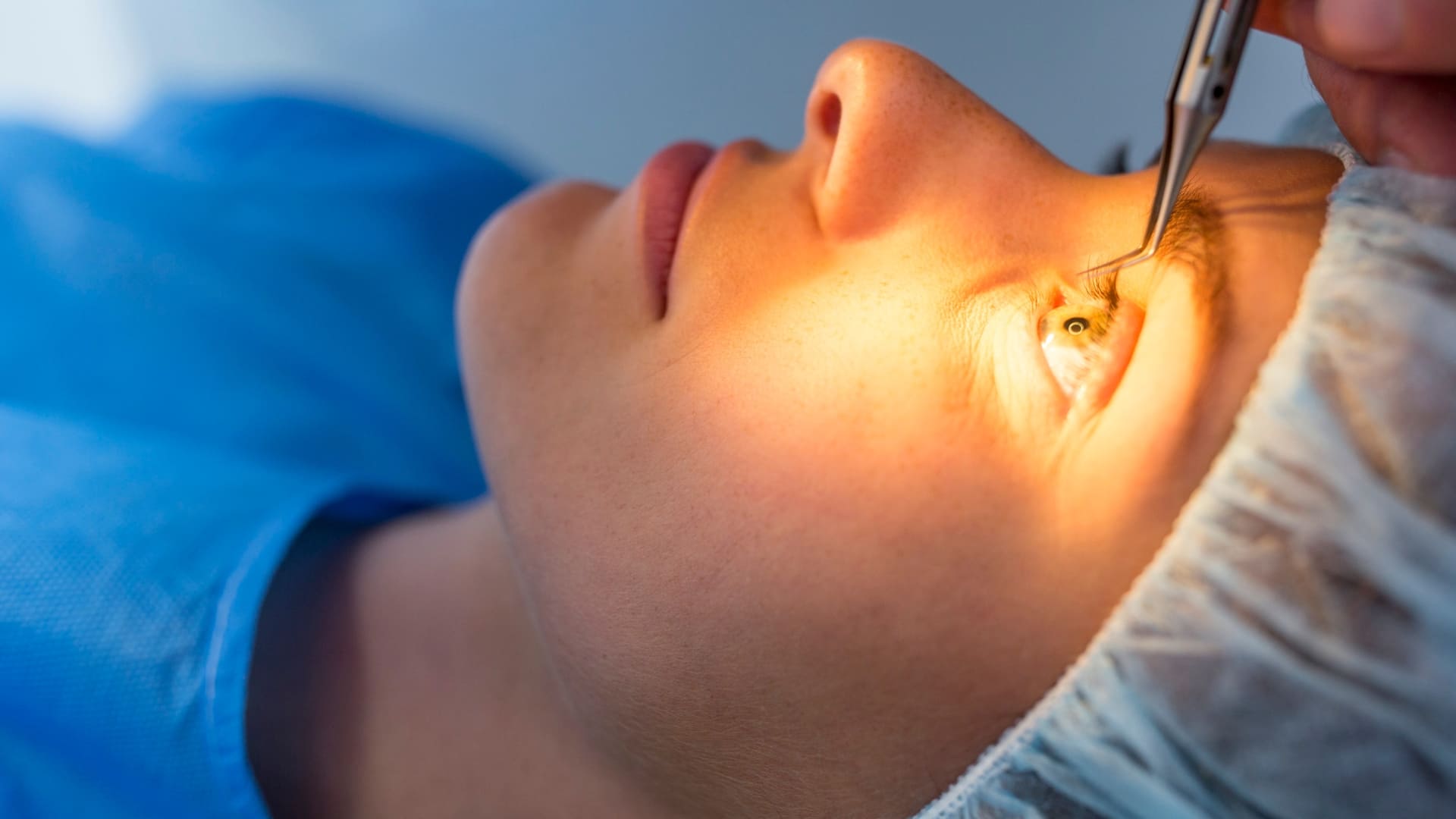 Lasik Surgery